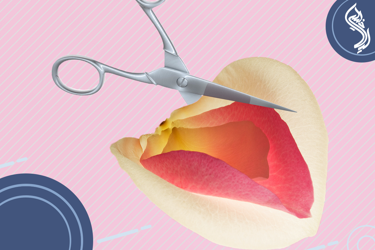 Laser-labiaplasty-process - دکتر خلیلی
