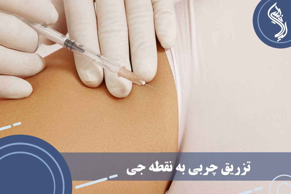 Fat-injection-to-point-G - دکتر خلیلی